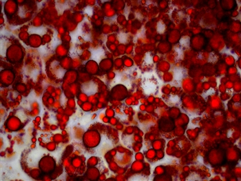 Oil Red O（オイルレッドO）染色失敗しないプロトコル